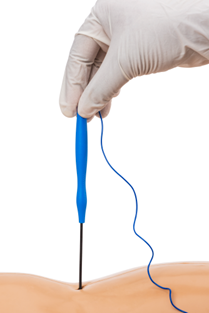 Phantom XL Pedicle Screw Probe, Single Use, 1/each, Sterile Pedicle ...