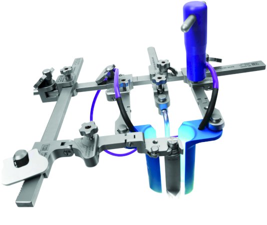 Phantom ML Counter Pivoting Step Over Retractor, Side-load, Sure-lock ...