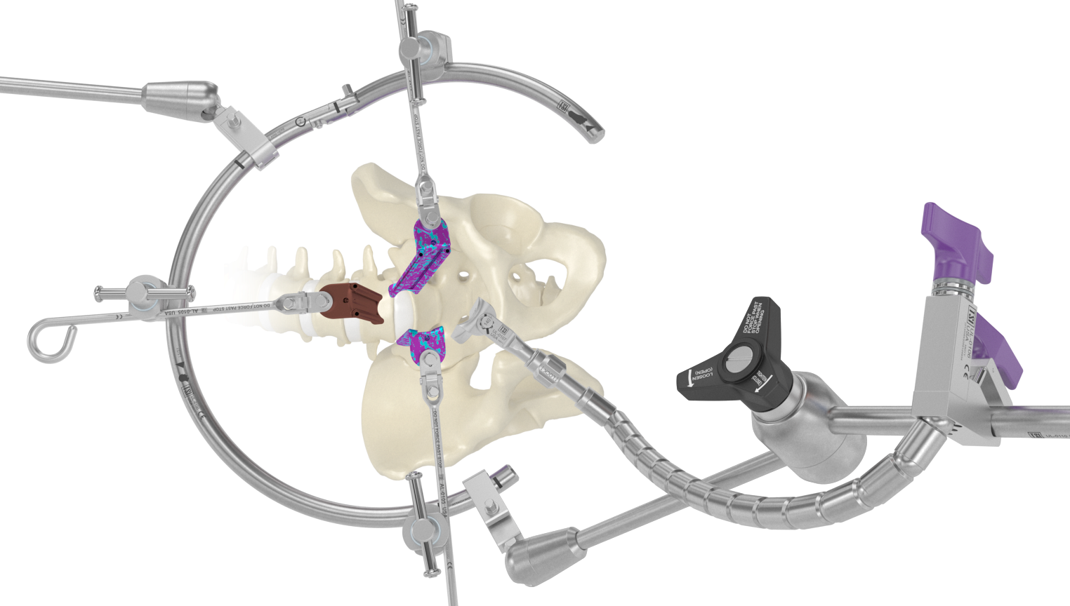 Anterior to the Psoas - Tedan Surgical Innovations