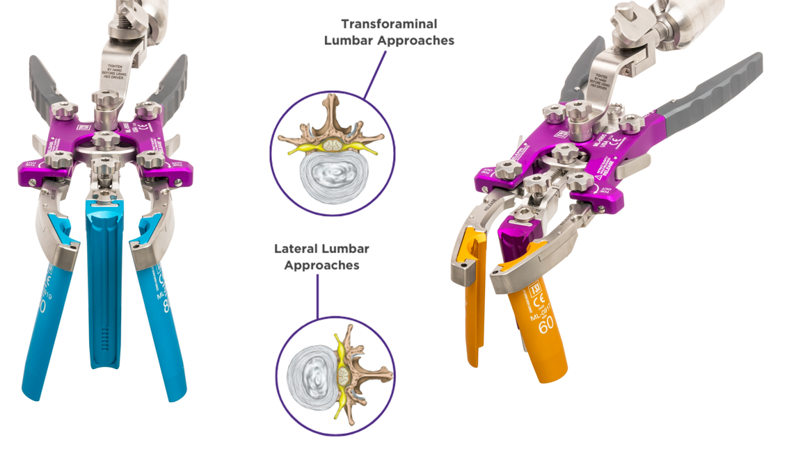Phantom ML3 MIS Lumbar Surgical Access System - Tedan Surgical Innovations