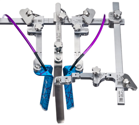 Phantom XL Lateral Lumbar Surgical Access System - Tedan Surgical ...
